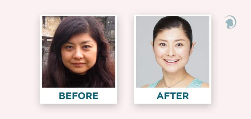 10 Astonishing Before And After Face Yoga Transformations