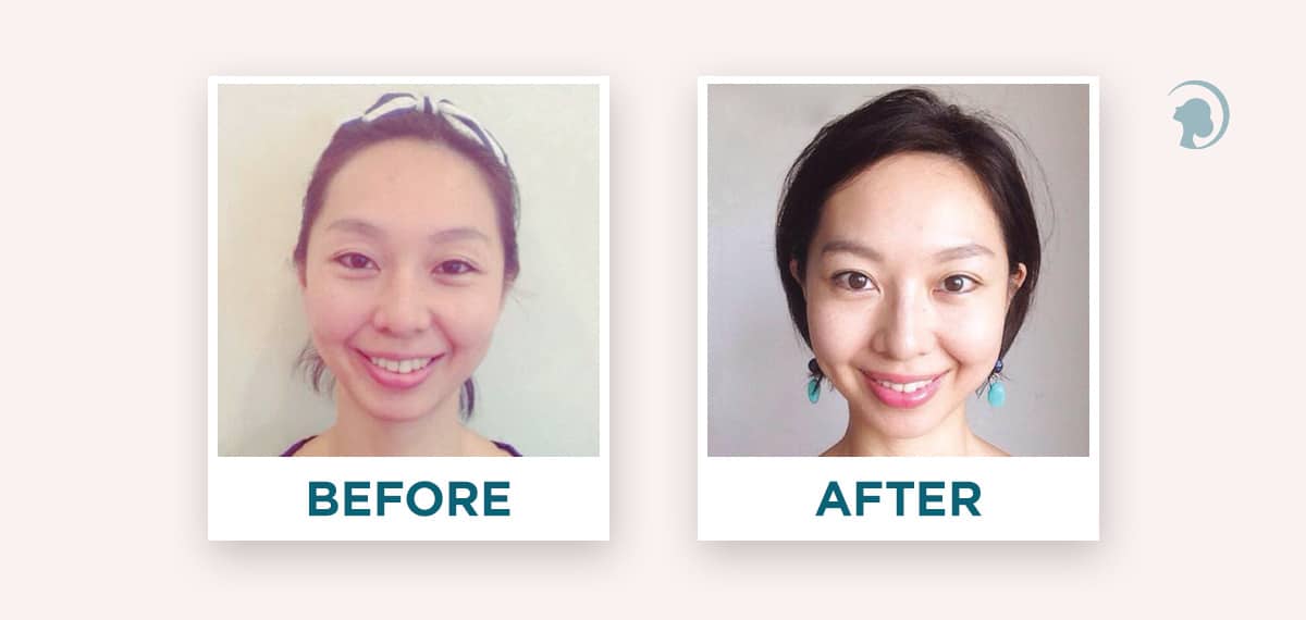 10 Astonishing Before And After Face Yoga Transformations